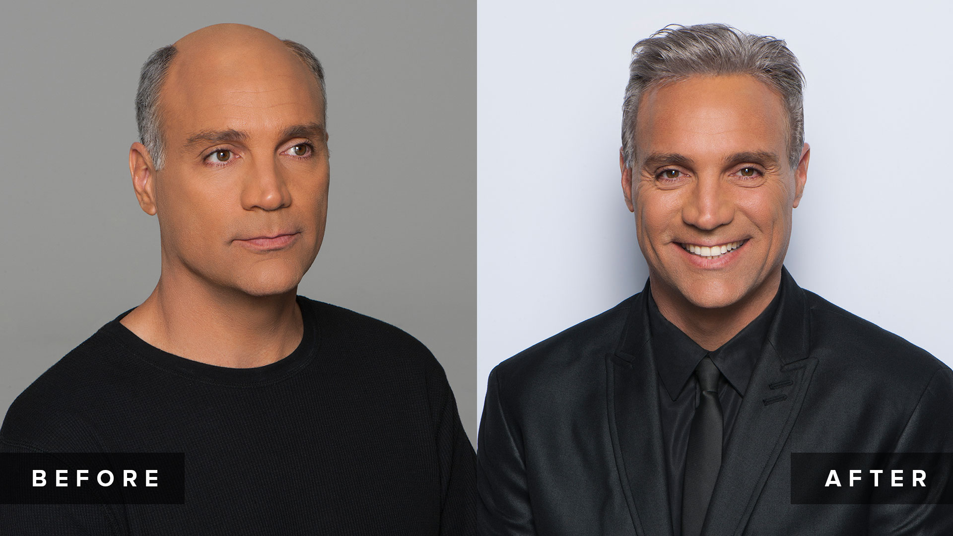 MENS BEFORE AND AFTER GALLERY - HRS of Portland