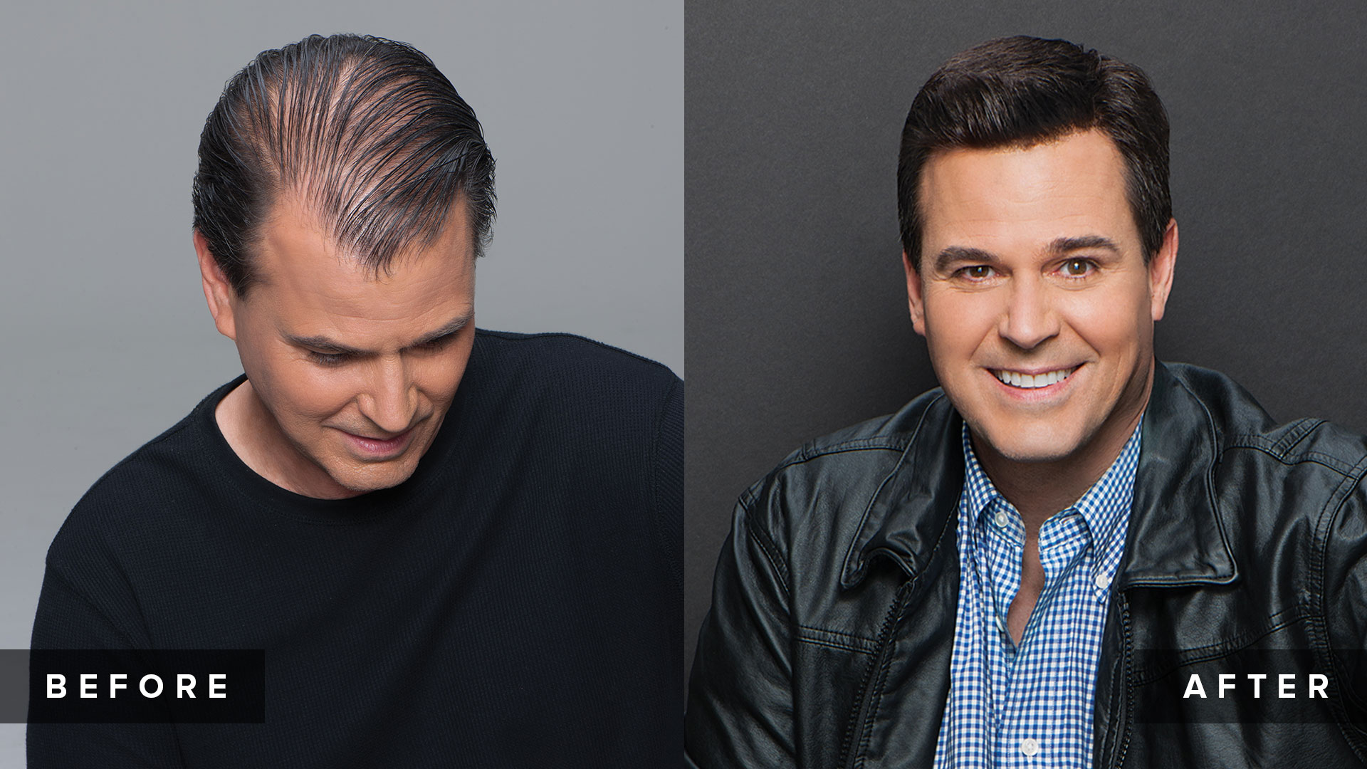 MENS BEFORE AND AFTER GALLERY - HRS of Portland